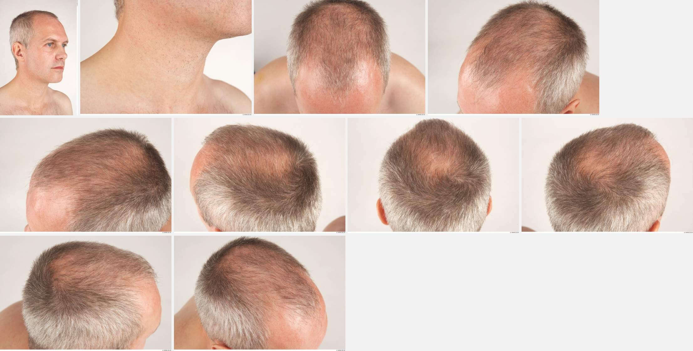 Albert High Res Skin Texture Photo Set by 3d-sk