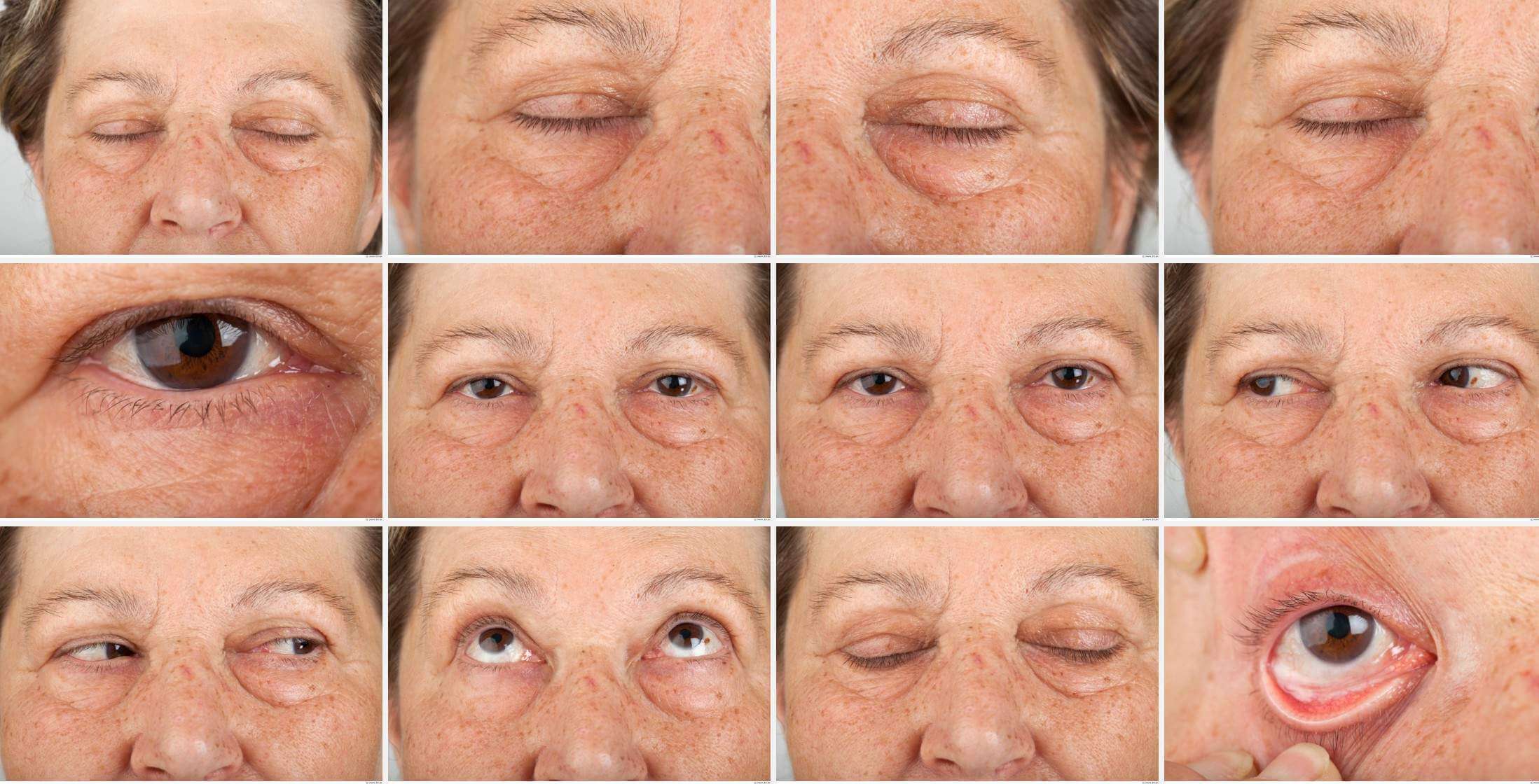 Chelsea High Res Skin Texture Photo Set by 3d-sk