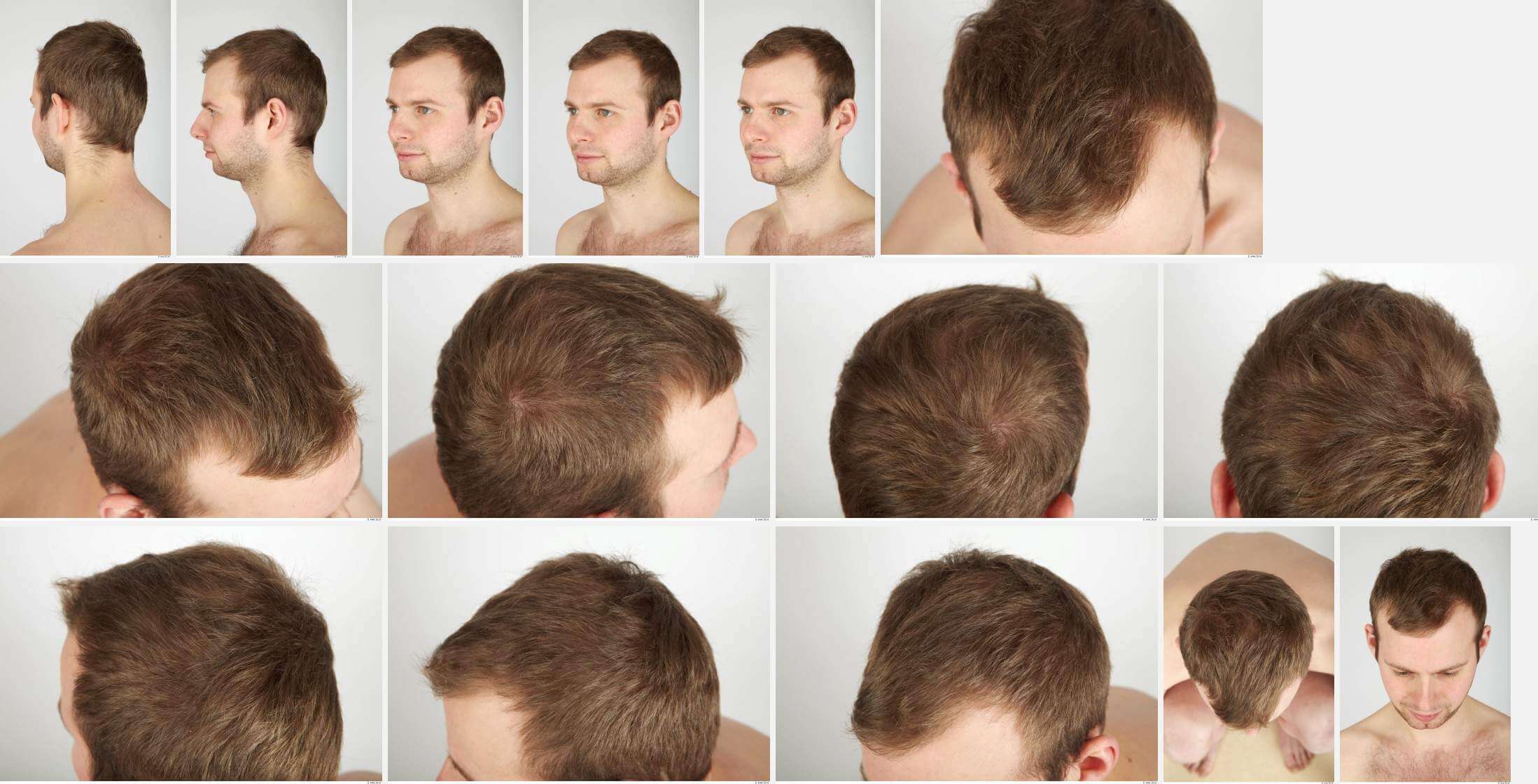 Drahomir High Res Skin Texture Photo Set by 3d-sk