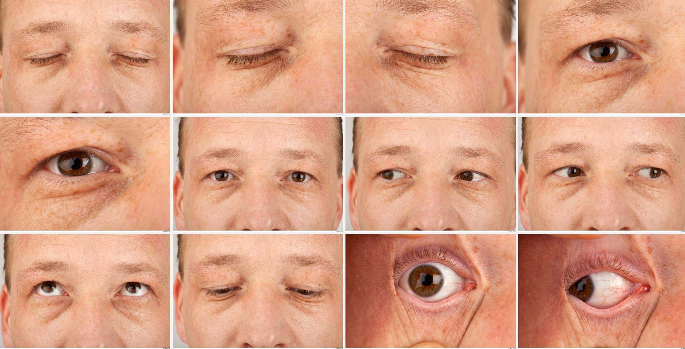 Garry High Res Skin Texture Photo Set by 3d-sk