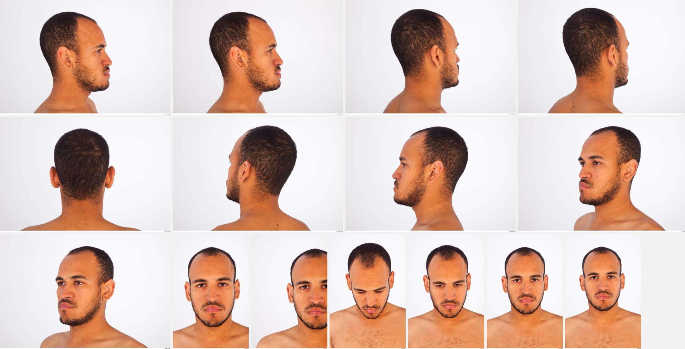 Glen High Res Skin Texture Photo Set by 3d-sk