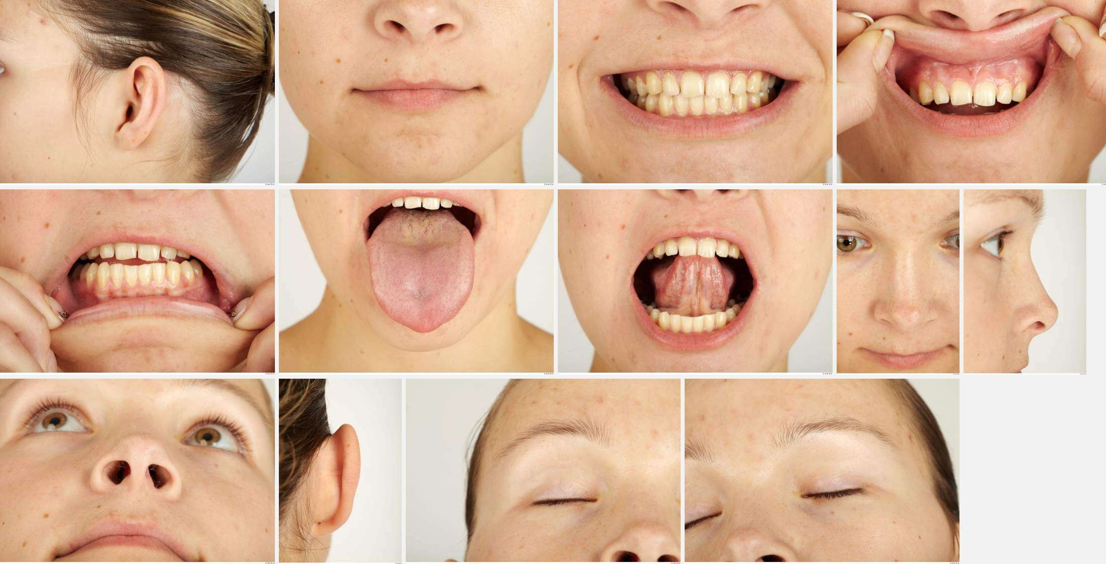 Henrieta High Res Skin Texture Photo Set by 3d-sk