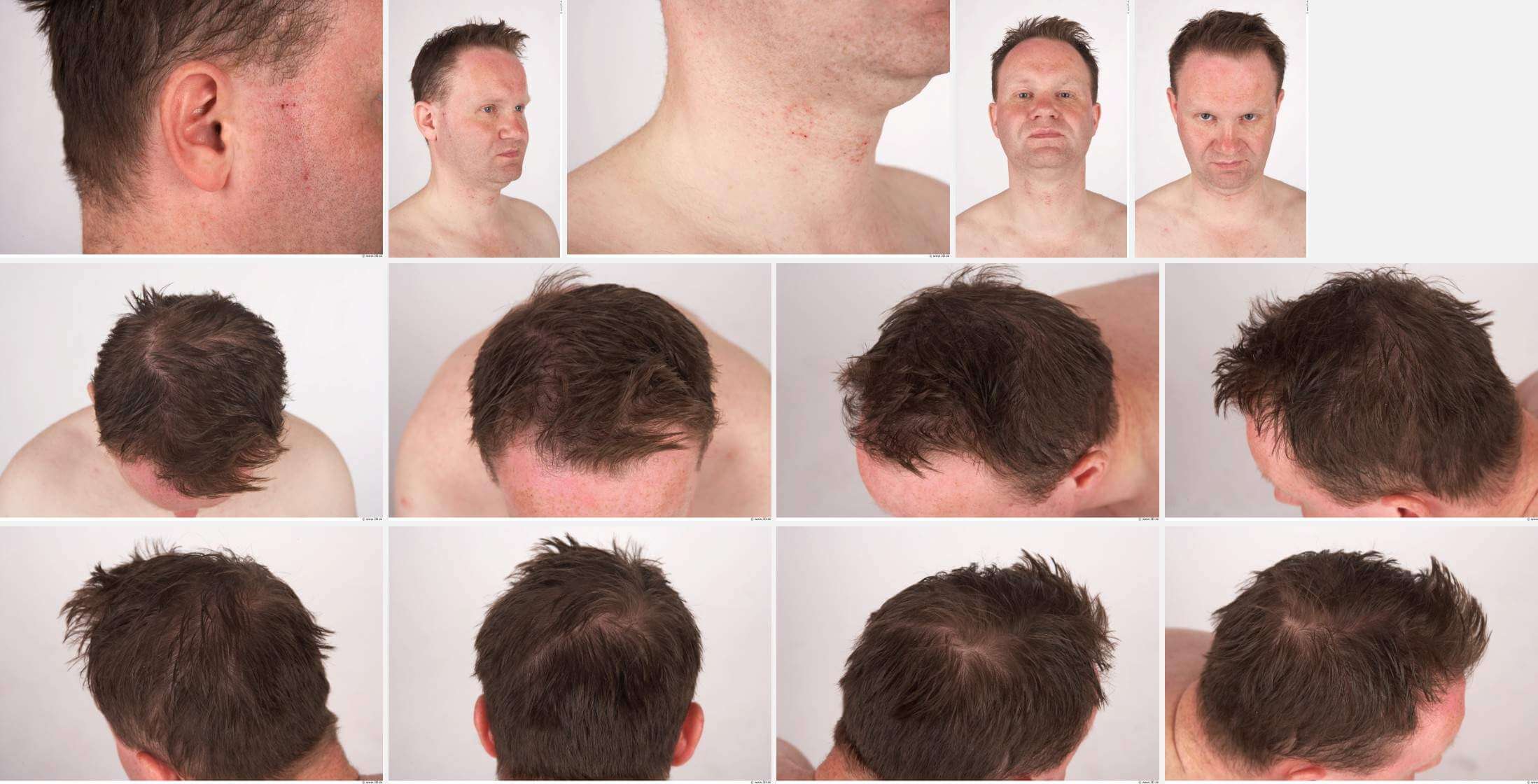 Herman High Res Skin Texture Photo Set by 3d-sk