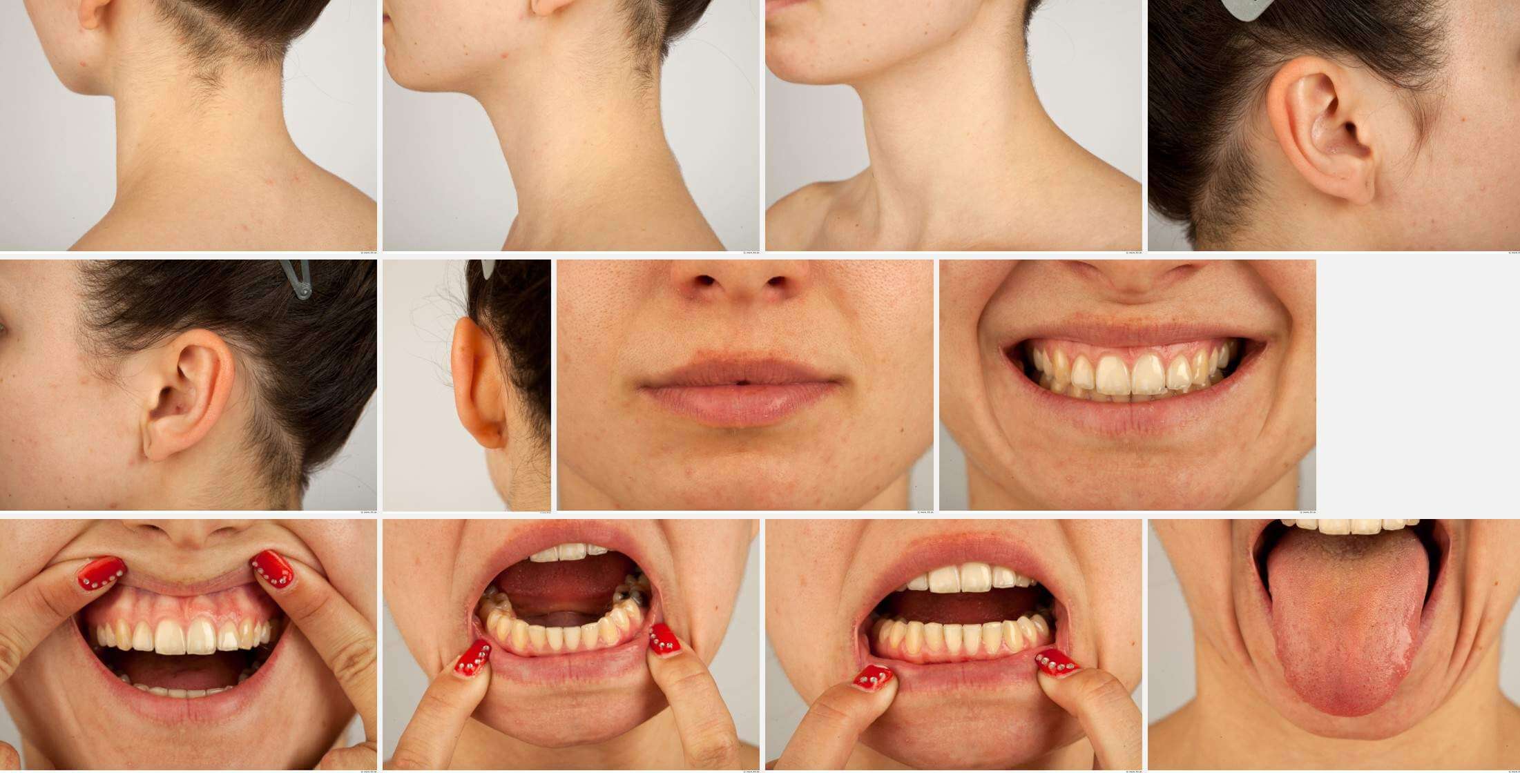 Opal High Res Skin Texture Photo Set by 3d-sk