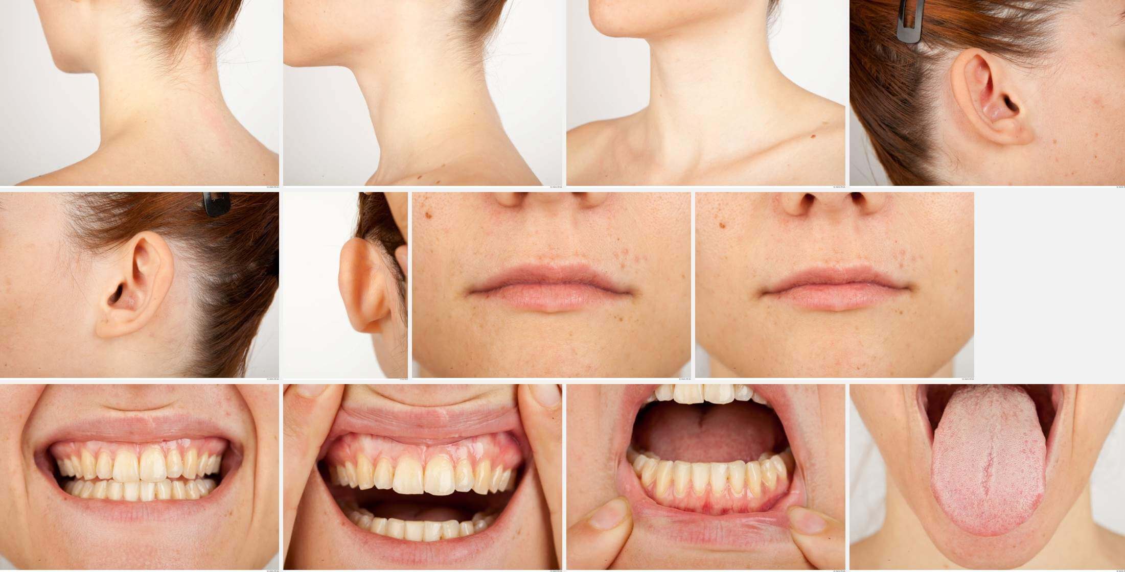 Patty High Res Skin Texture Photo Set by 3d-sk