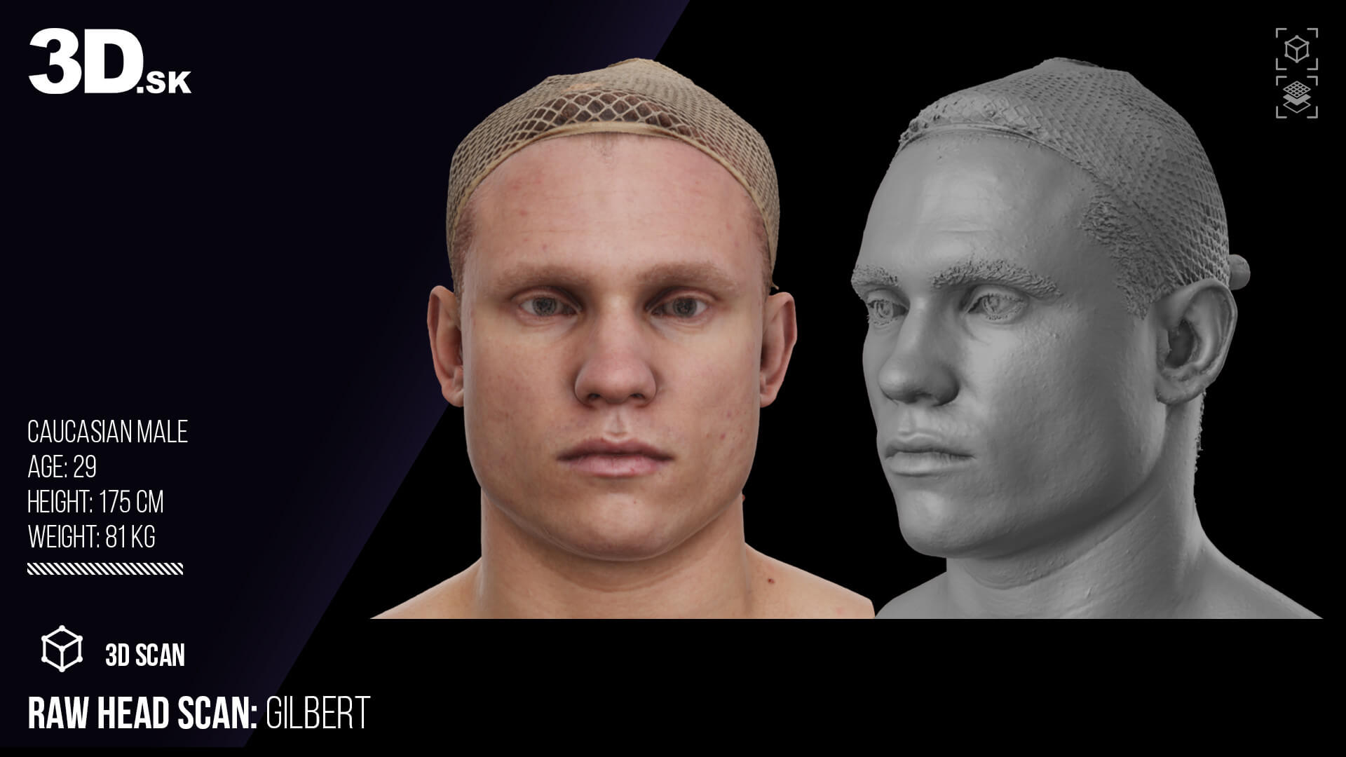 Raw Head Scan Gilbert - 3D Model by 3d-sk