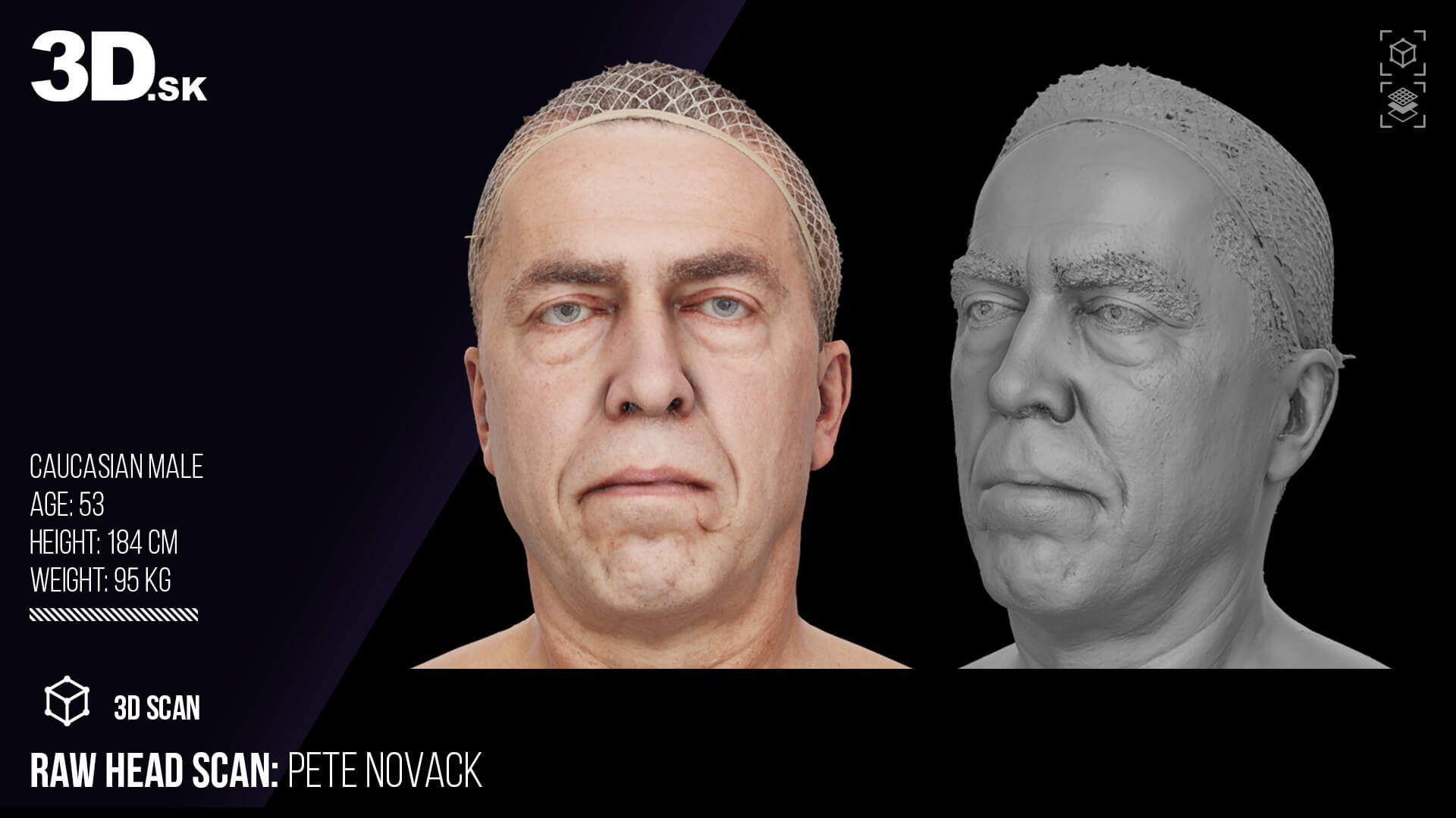Raw Head Scan Pete Novack - 3D Model by 3d-sk