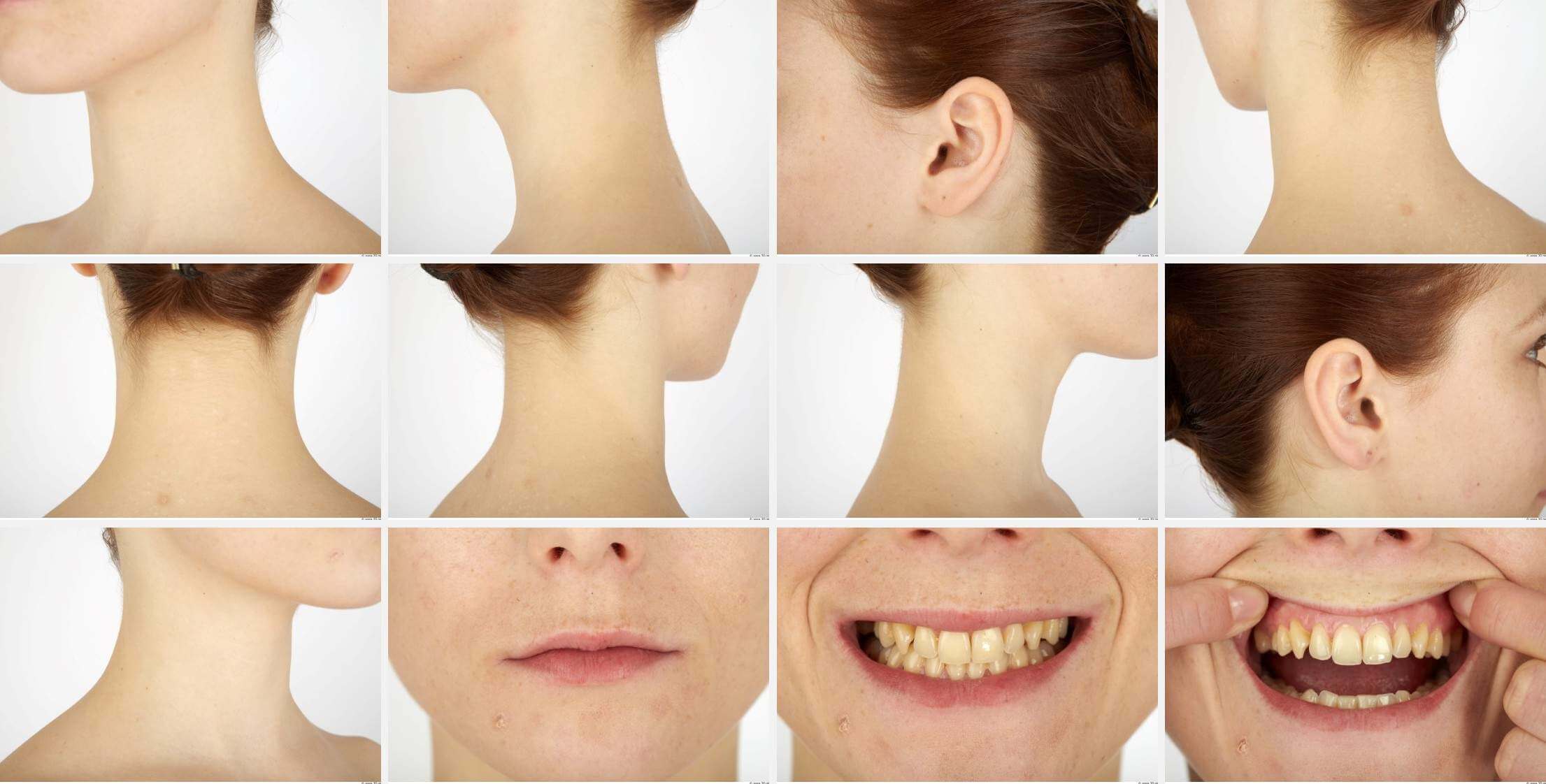 Zelmira High Res Skin Texture Photo Set by 3d-sk