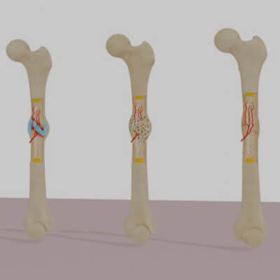 Human Long Bone Structure Internal Anatomy and Healing - 3D Model by ...