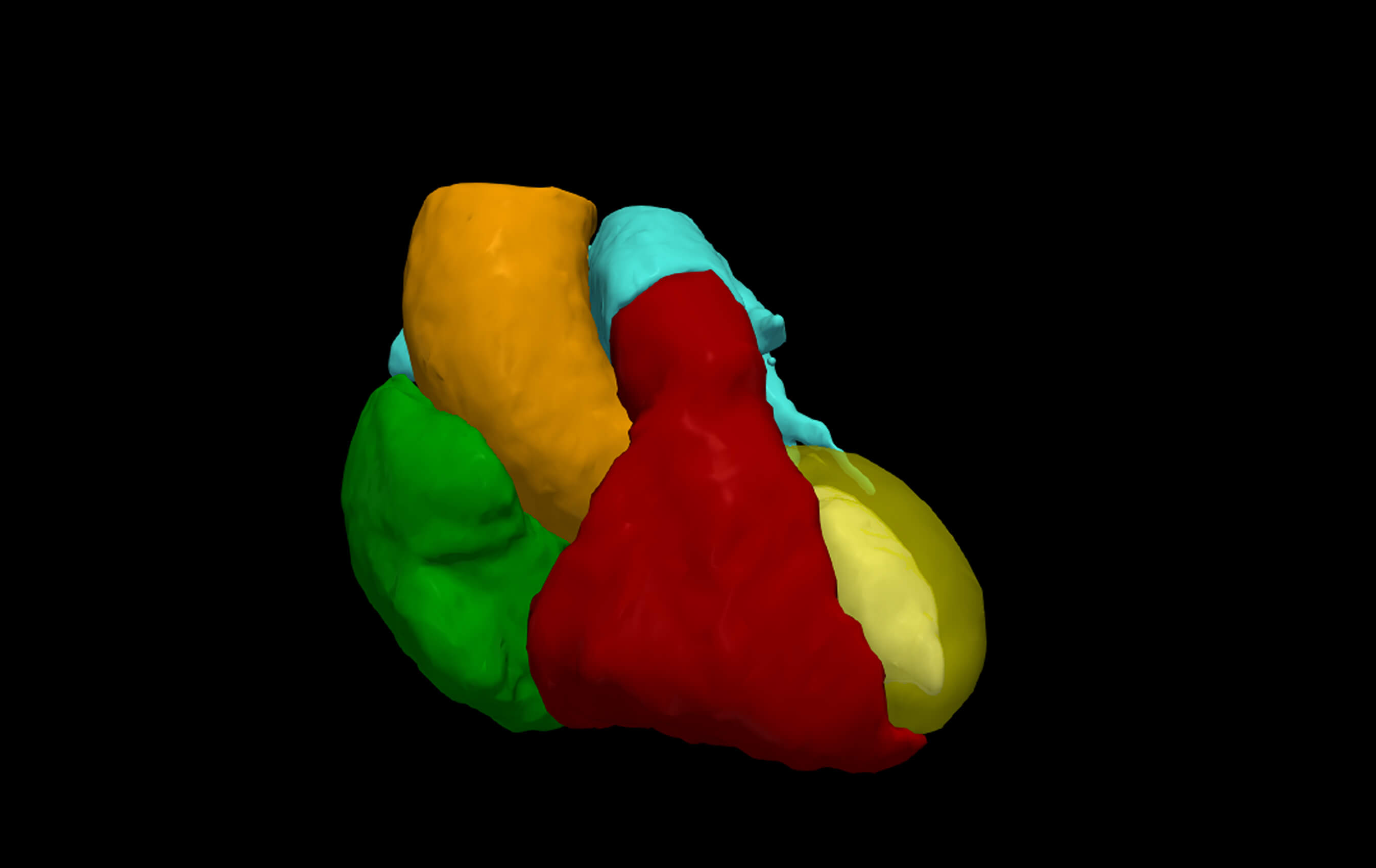 3D Heart Model - Generated From Real Patient by azekapeka