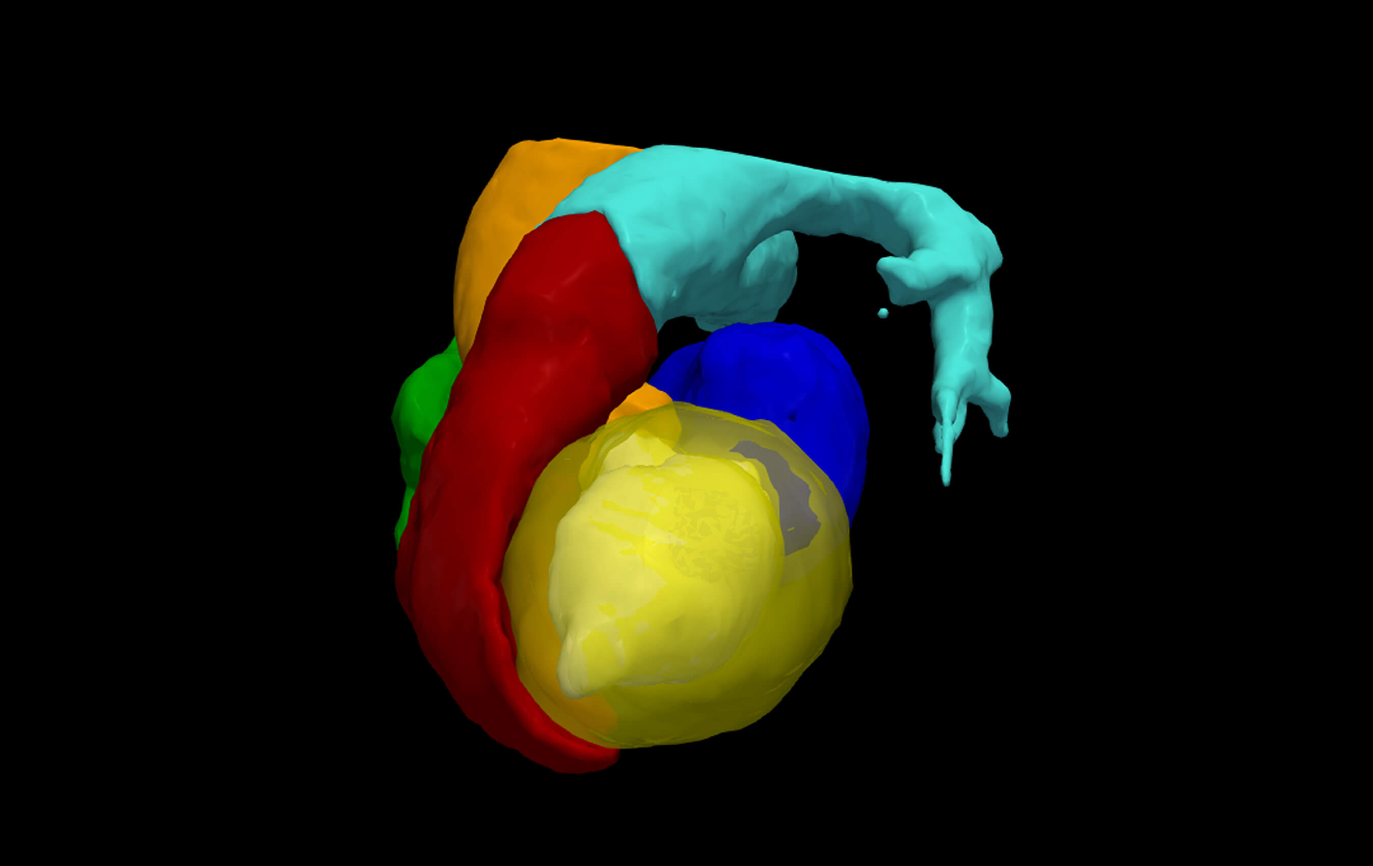 3D Heart Model - Generated From Real Patient by azekapeka