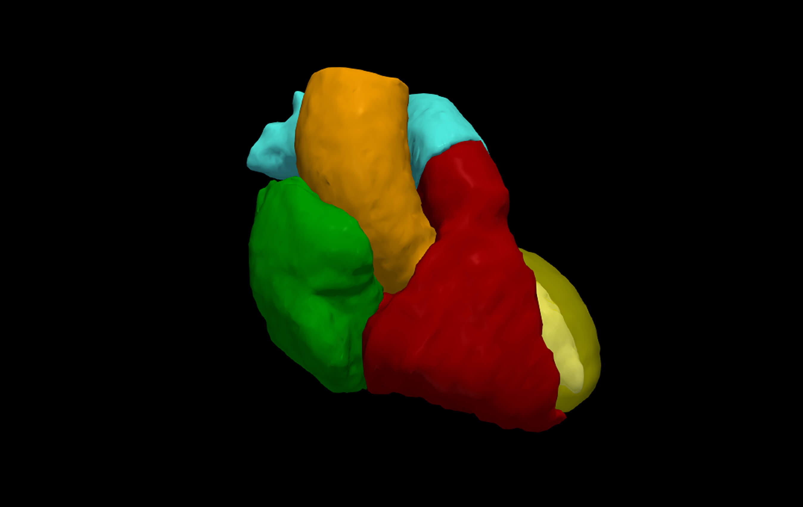 3D Heart Model - Generated From Real Patient by azekapeka