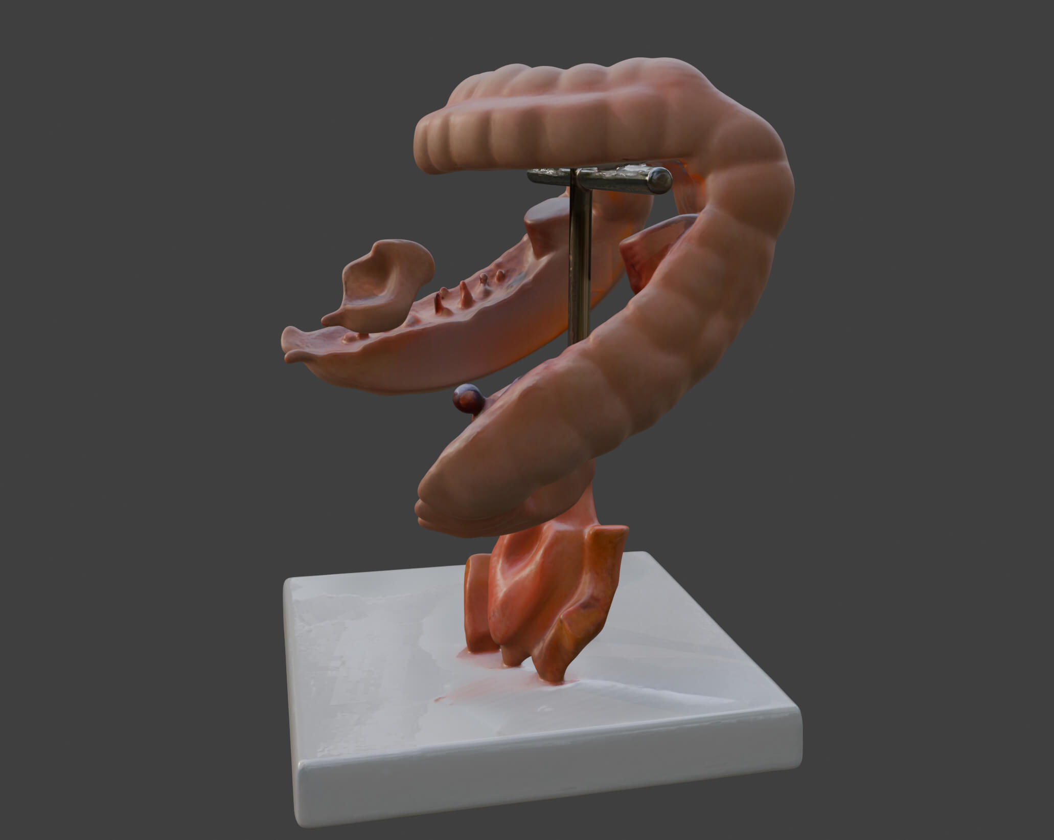 3D Model of Intestinal Diseases by azekapeka