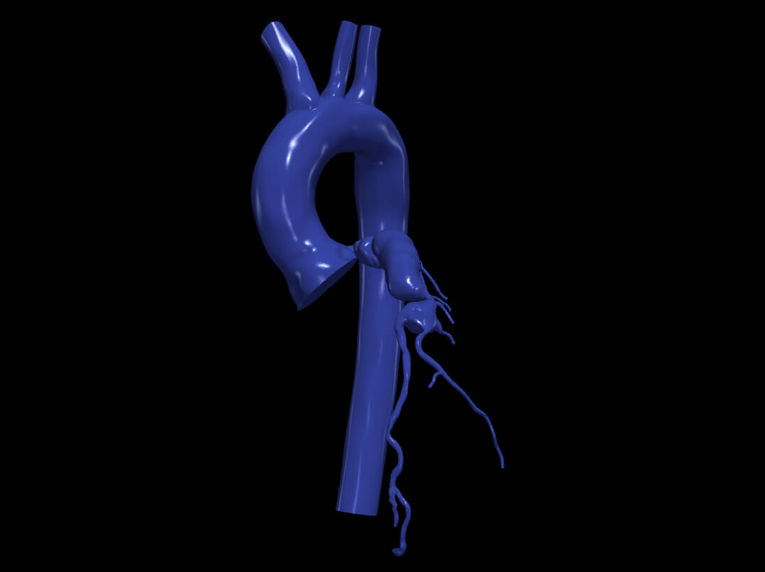 3D Model of Aorta and Coronary Arteries by azekapeka
