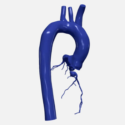 azekapeka | 3D Models | Arteries