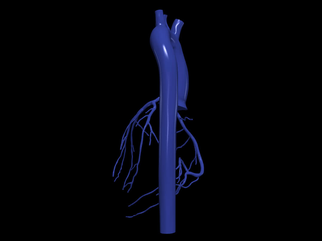 3D Model of Aorta and Coronary Arteries by azekapeka