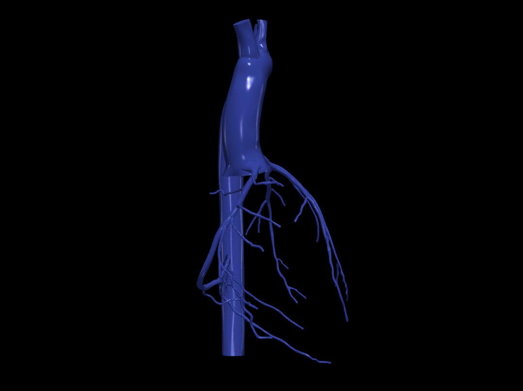 3D Model of Aorta and Coronary Arteries by azekapeka