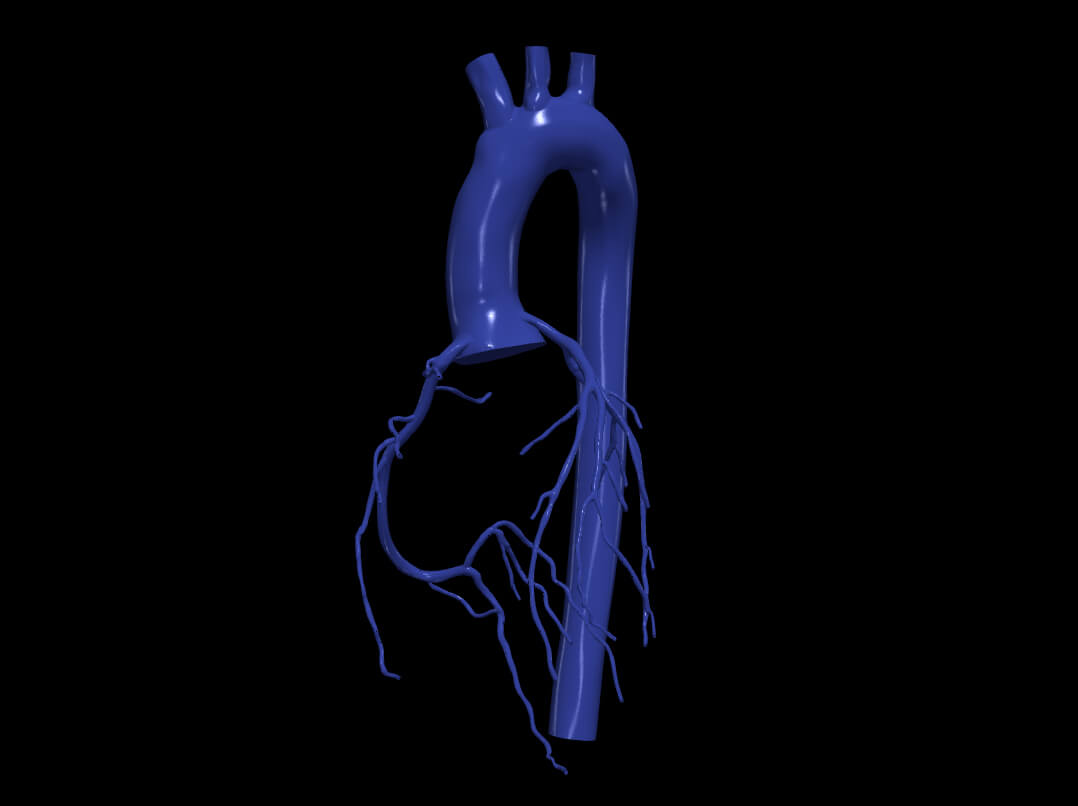 3D Model of Aorta and Coronary Arteries by azekapeka
