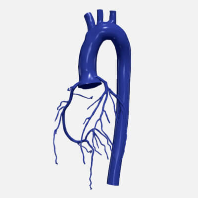 3D Model of Aorta and Coronary Arteries by azekapeka