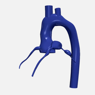 3D Model of Aorta and Coronary Arteries by azekapeka