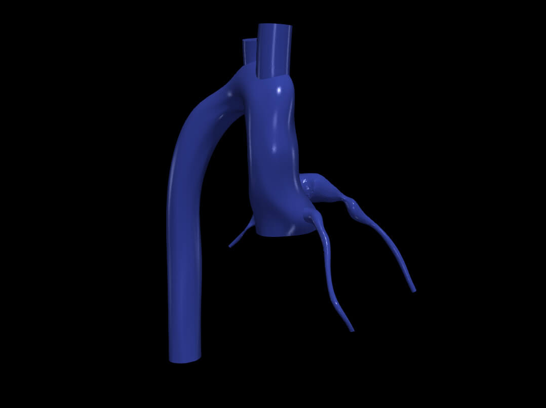 3D Model of Aorta and Coronary Arteries - 6Pack by azekapeka