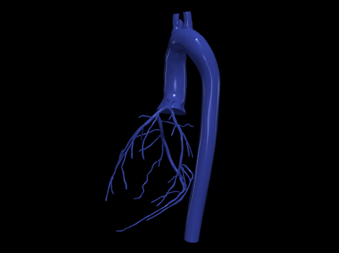 3D Model of Aorta and Coronary Arteries - 6Pack by azekapeka