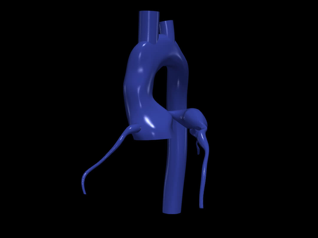 3D Model of Aorta and Coronary Arteries - 6Pack by azekapeka