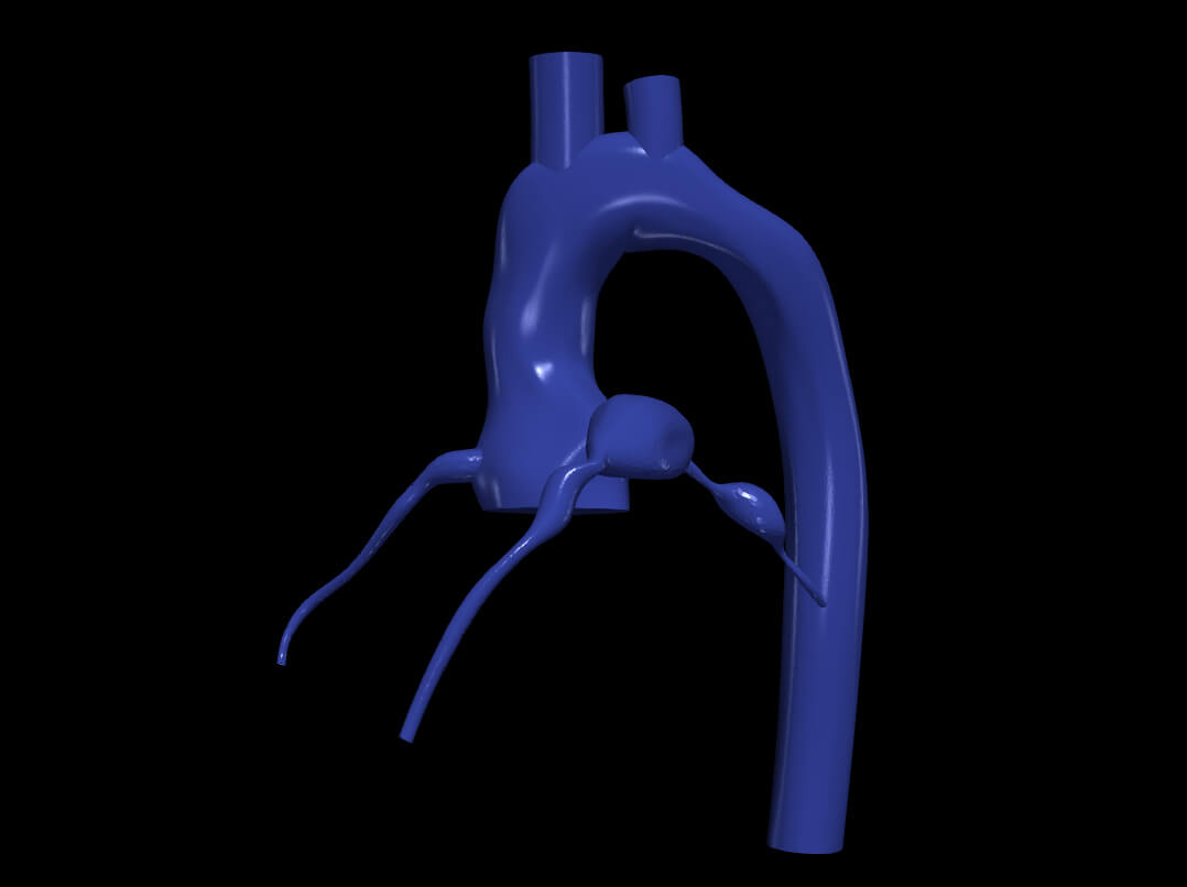 3D Model of Aorta and Coronary Arteries - 6Pack by azekapeka