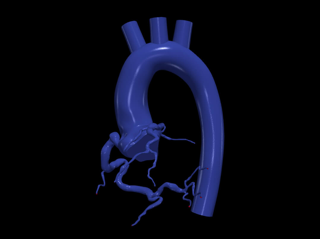 3D Model of Aorta and Coronary Arteries - 6Pack by azekapeka