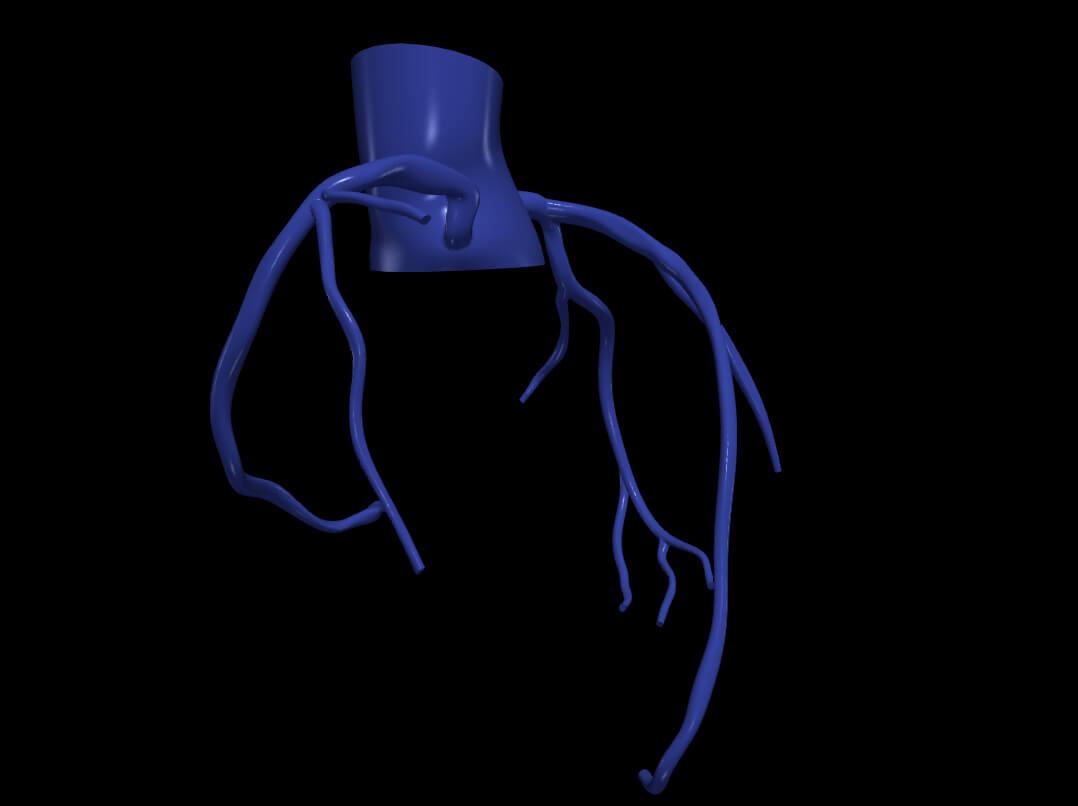 3D Model of Aorta and Coronary Arteries - 6Pack by azekapeka