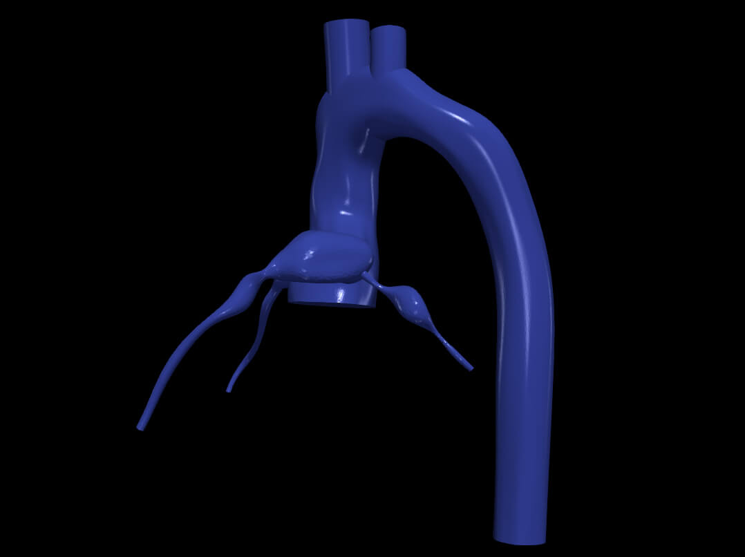3D Model of Aorta and Coronary Arteries - 6Pack by azekapeka
