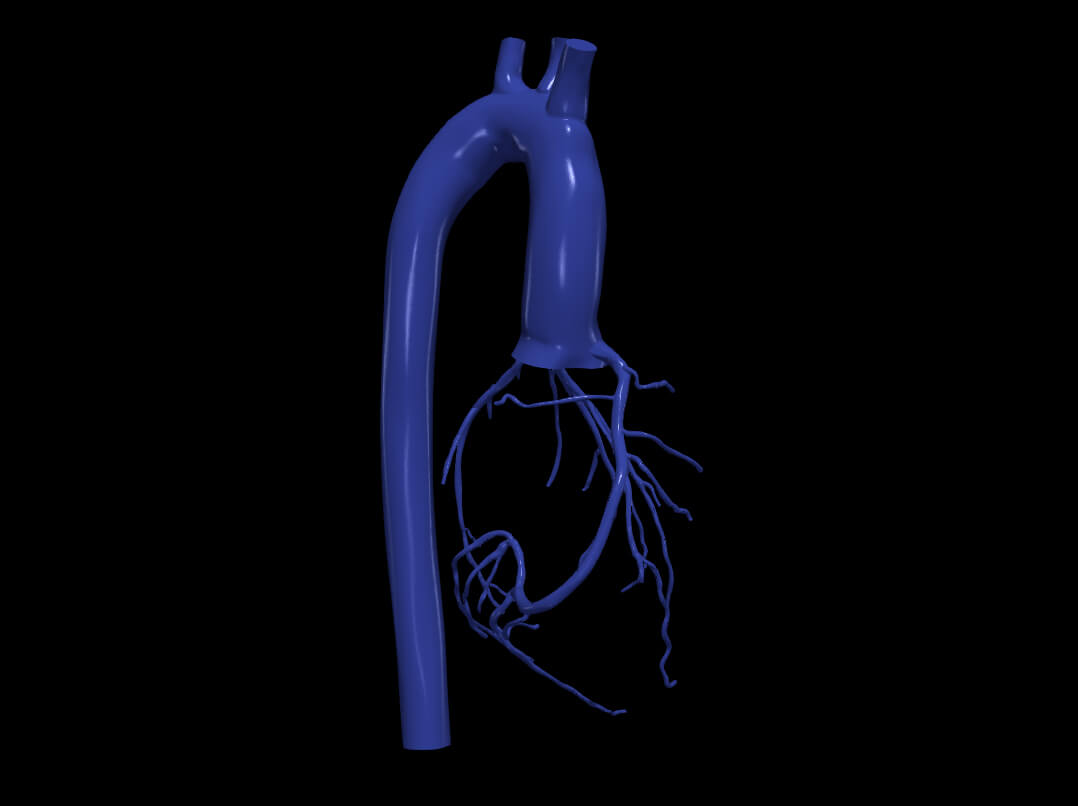 3D Model of Aorta and Coronary Arteries - 6Pack by azekapeka