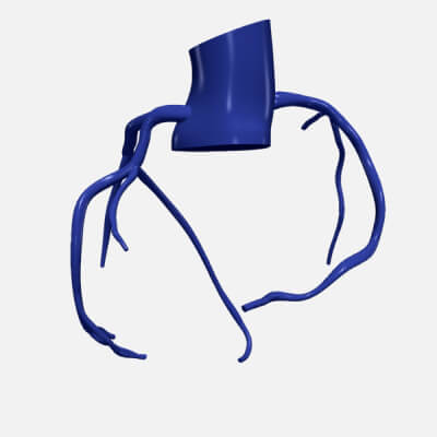 3D Model of Aorta and Coronary Arteries by azekapeka