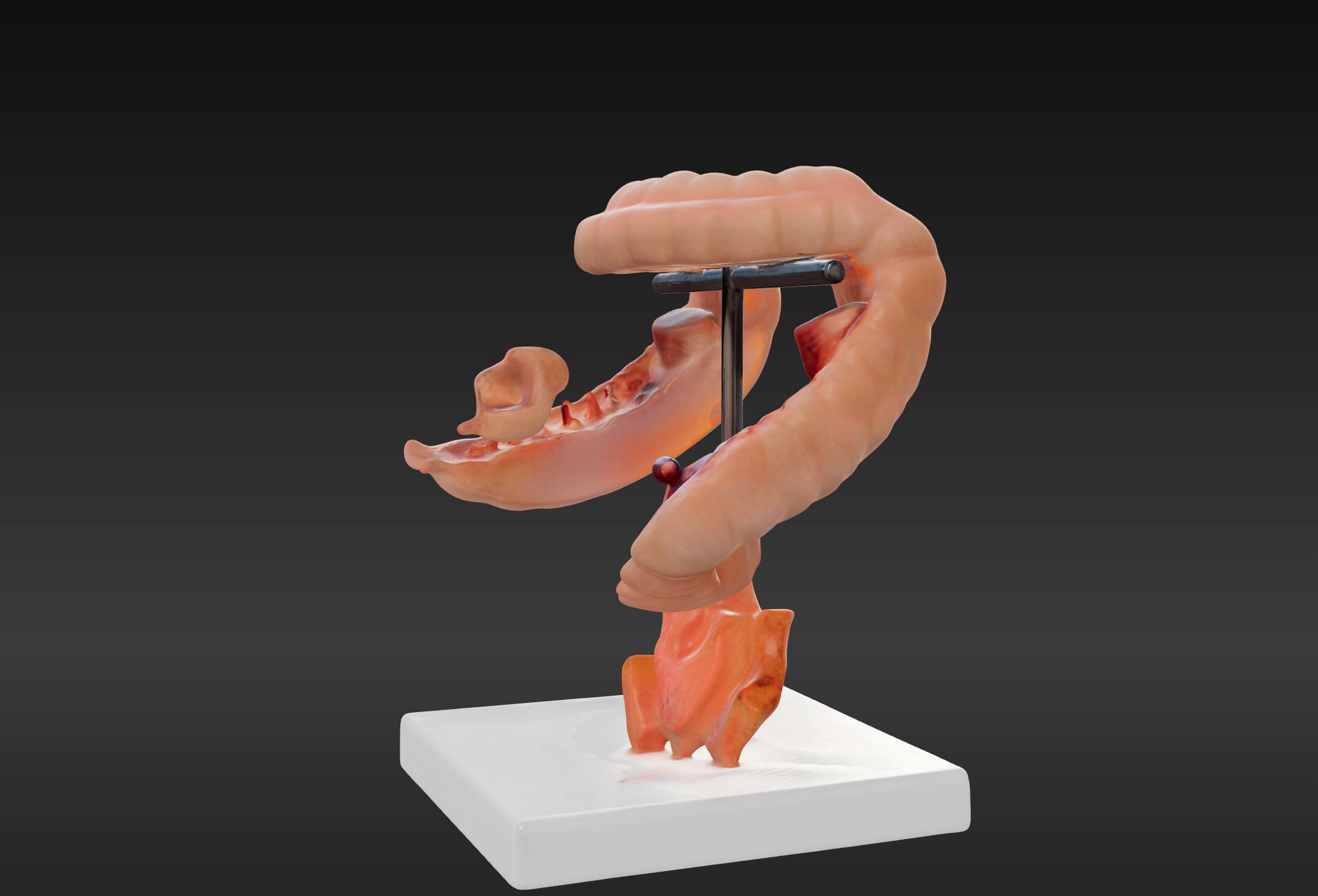 3D Model of Caecum and Appendix by azekapeka