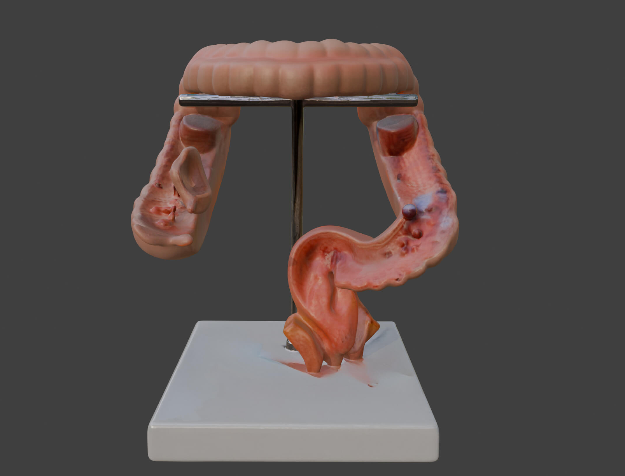 3D Model of Caecum and Appendix by azekapeka