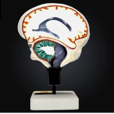 3D Model of Cerebrospinal Fluid Brain by azekapeka