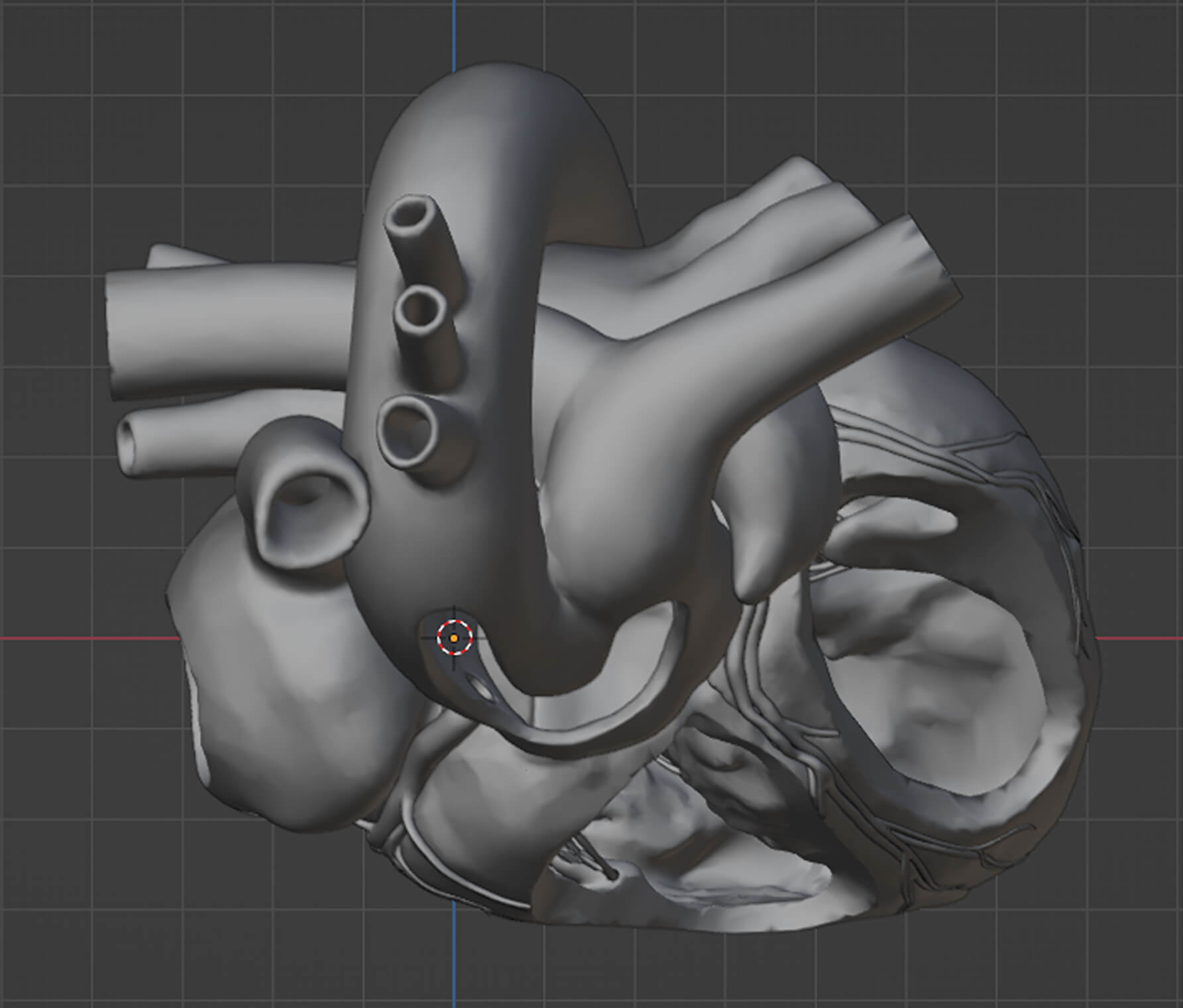 3D Model of Common Arterial Trunk Truncus Arteriosus by azekapeka