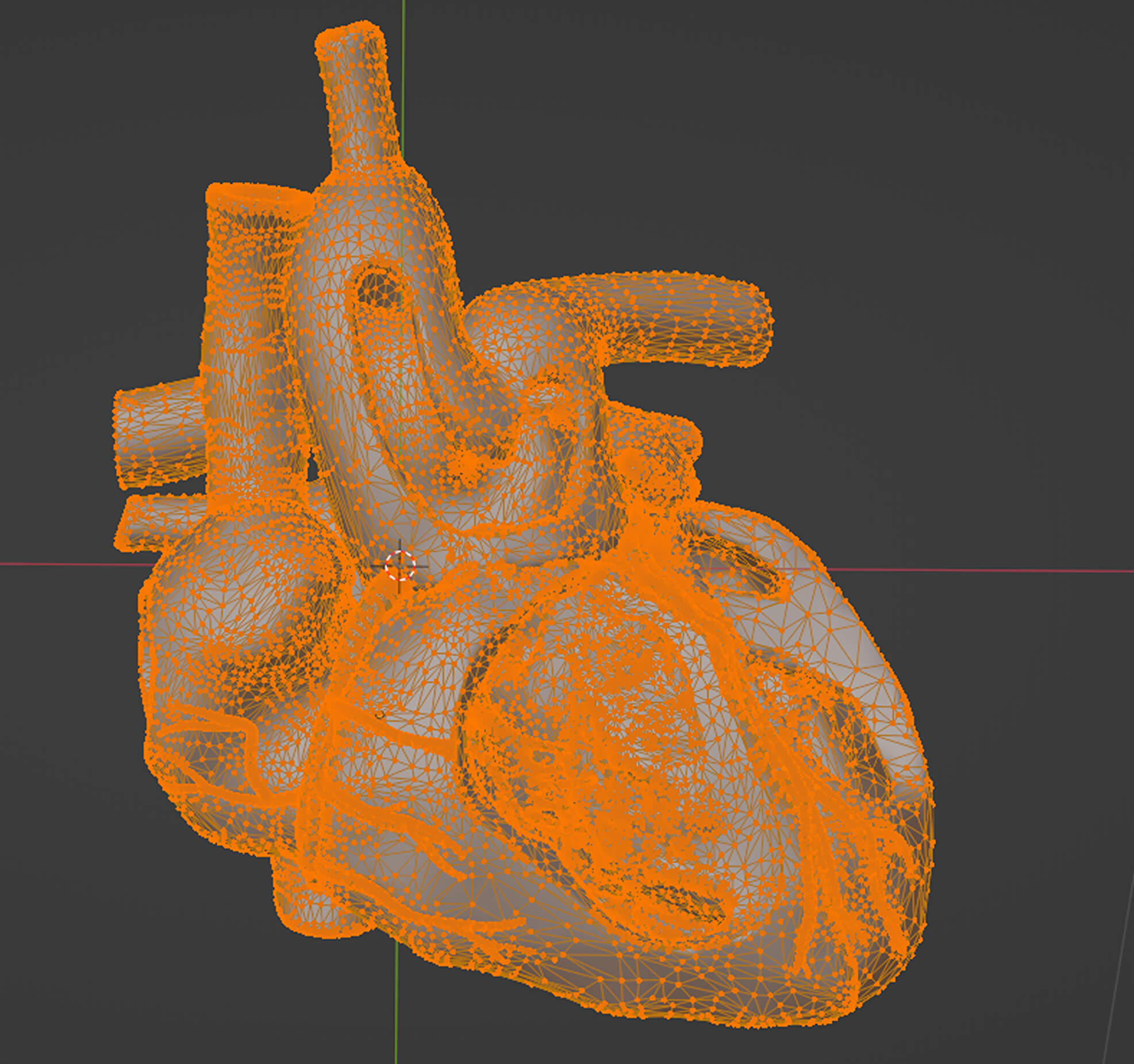 3D Model of Common Arterial Trunk Truncus Arteriosus by azekapeka
