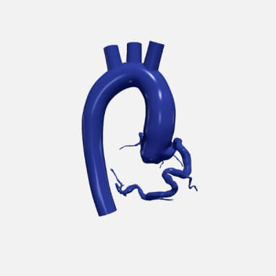 azekapeka | 3D Models | Arteries