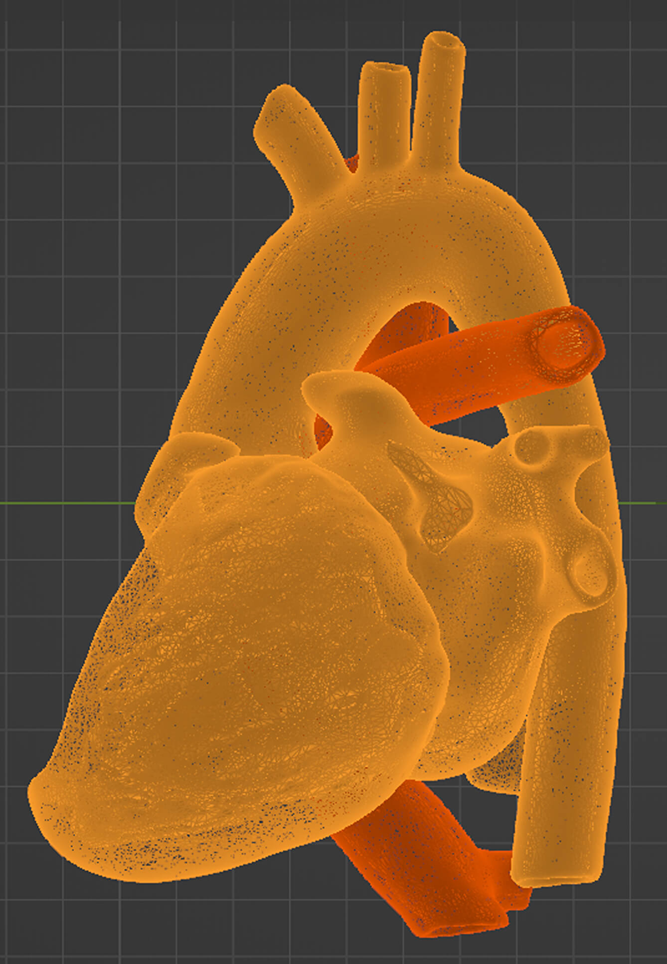 3D Model of Heart After Fontan Procedure by azekapeka