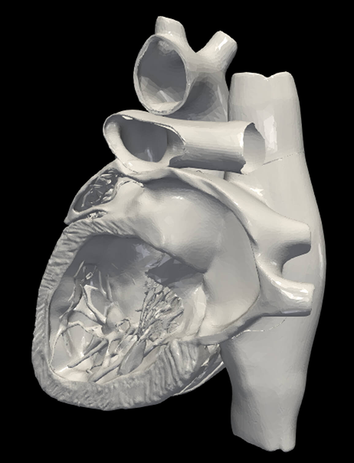 3D Model of Heart (Apical 2 Chamber Plane) by azekapeka