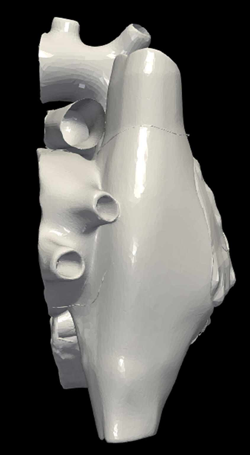 3D Model of Heart (Apical 2 Chamber Plane) by azekapeka