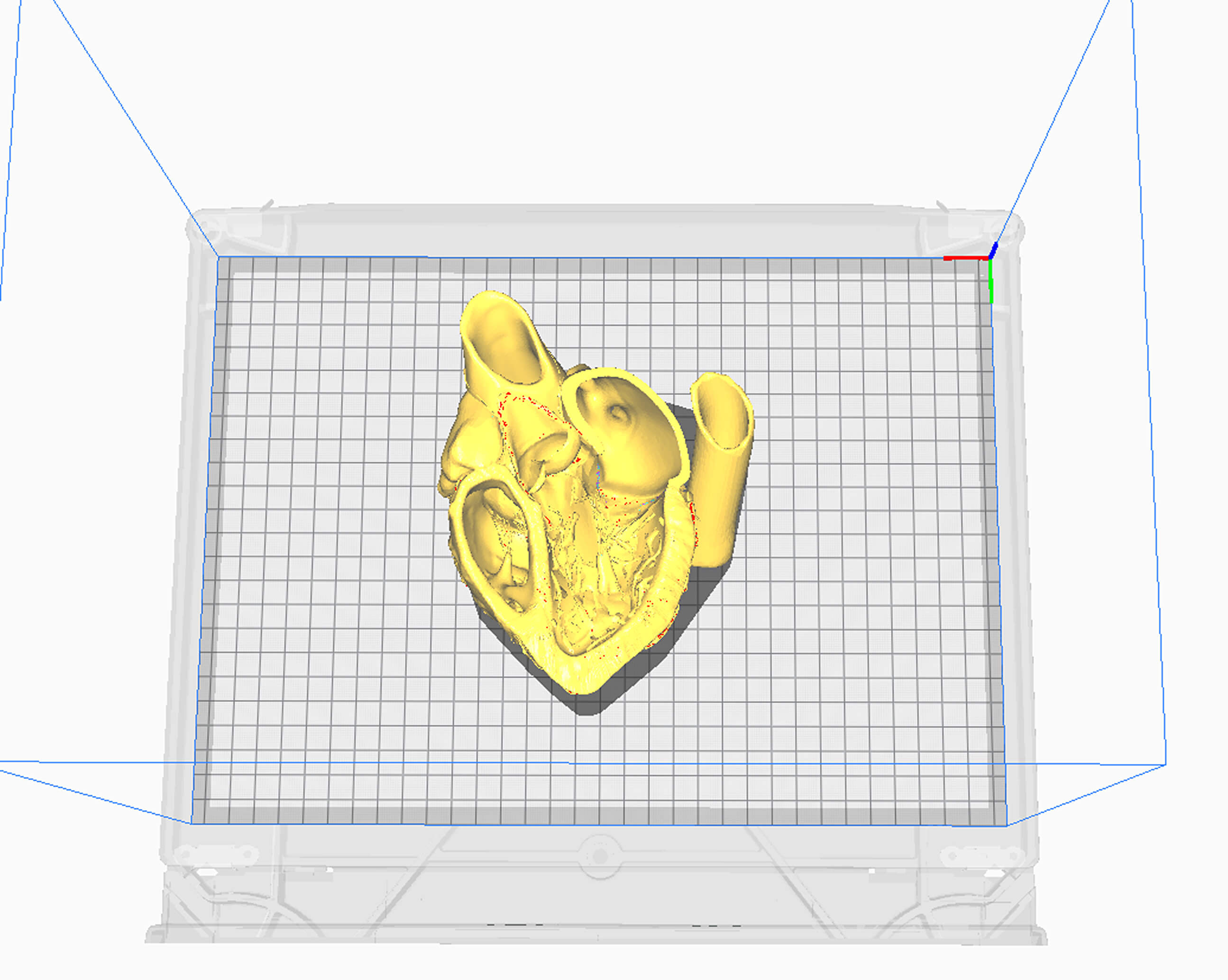 3D Model of Heart (Apical 3 Chamber Plane) by azekapeka