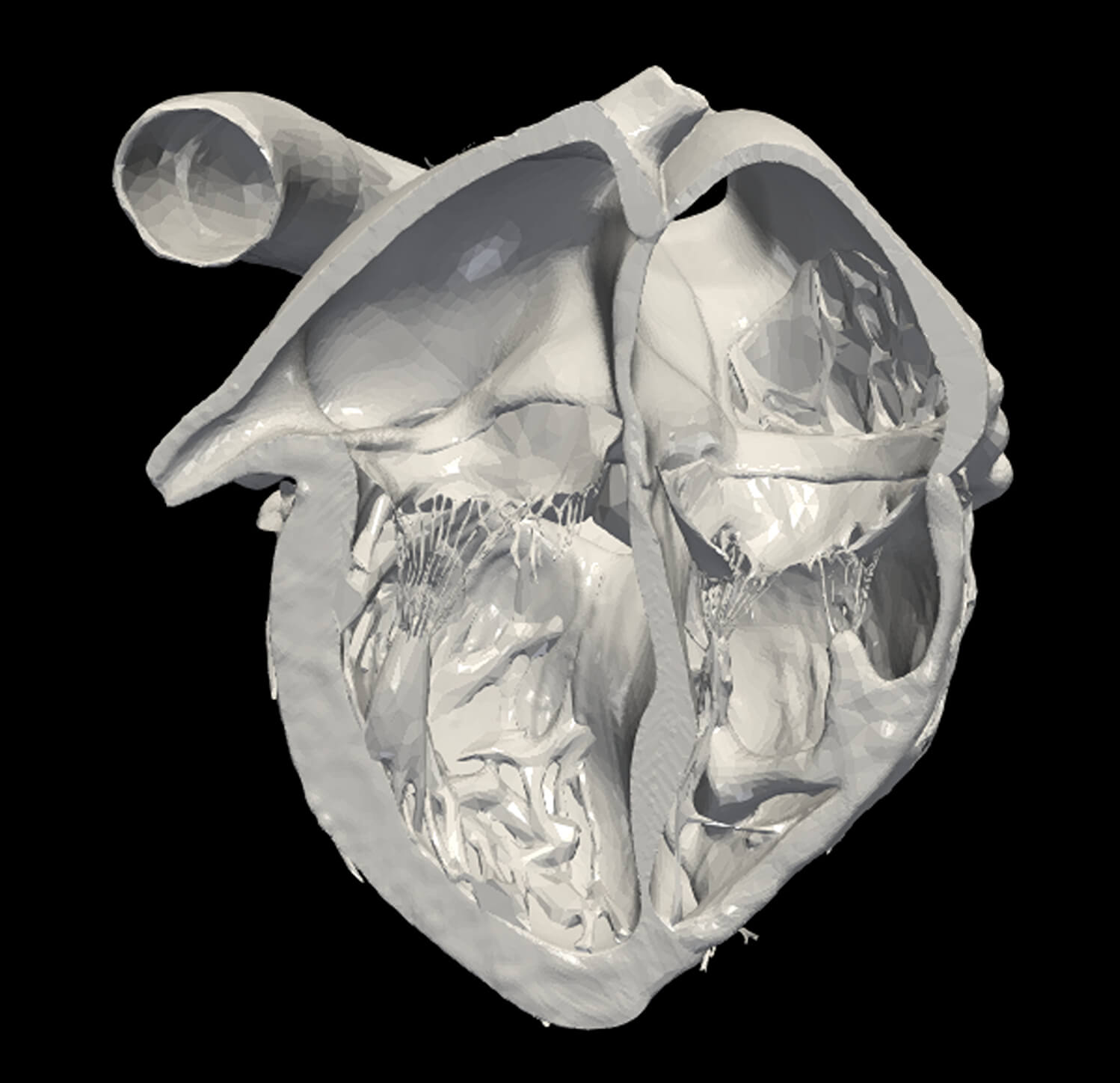 3D Model of Heart (Apical 4 Chamber Plane) by azekapeka