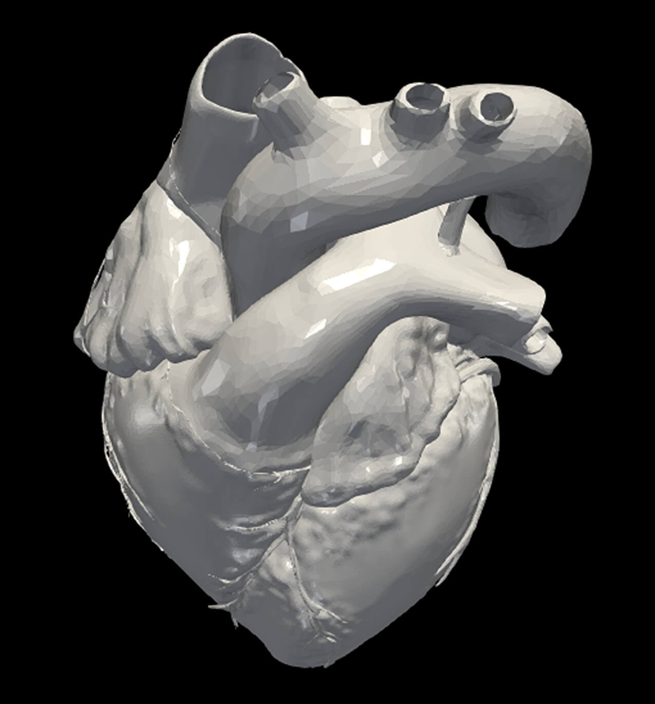 3D Model of Heart (Apical 4 Chamber Plane) by azekapeka
