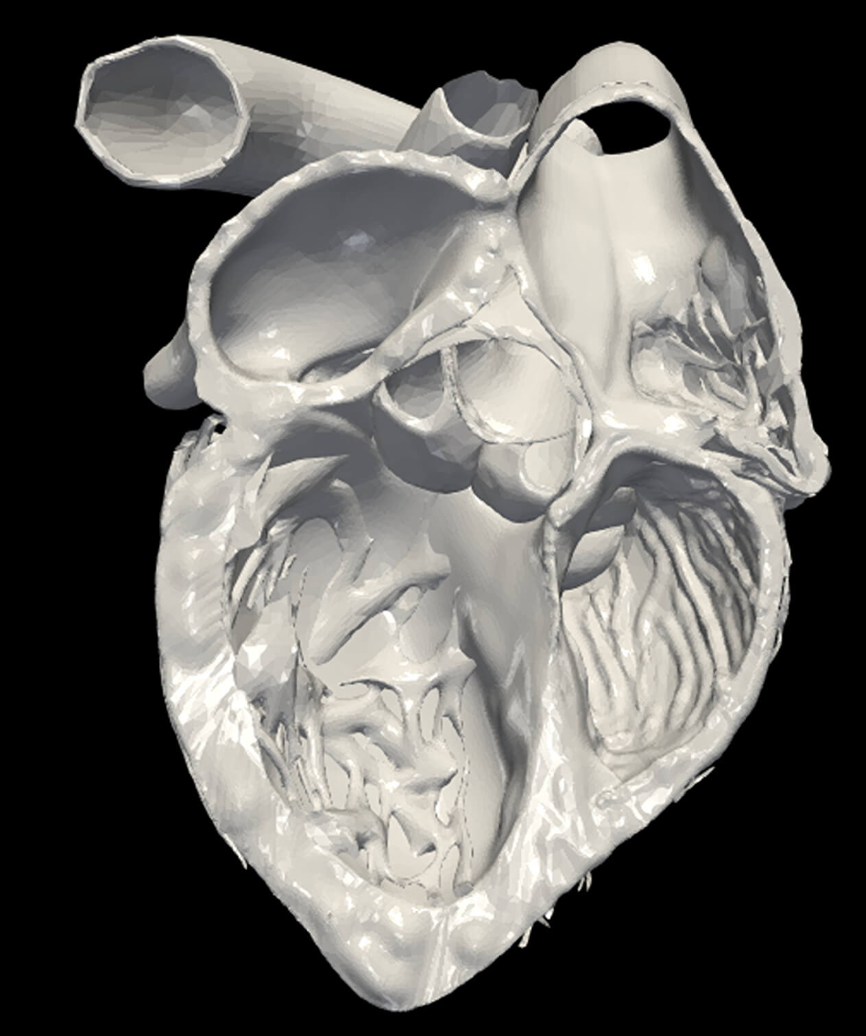 3D Model of Heart (Apical 5 Chamber Plane) by azekapeka