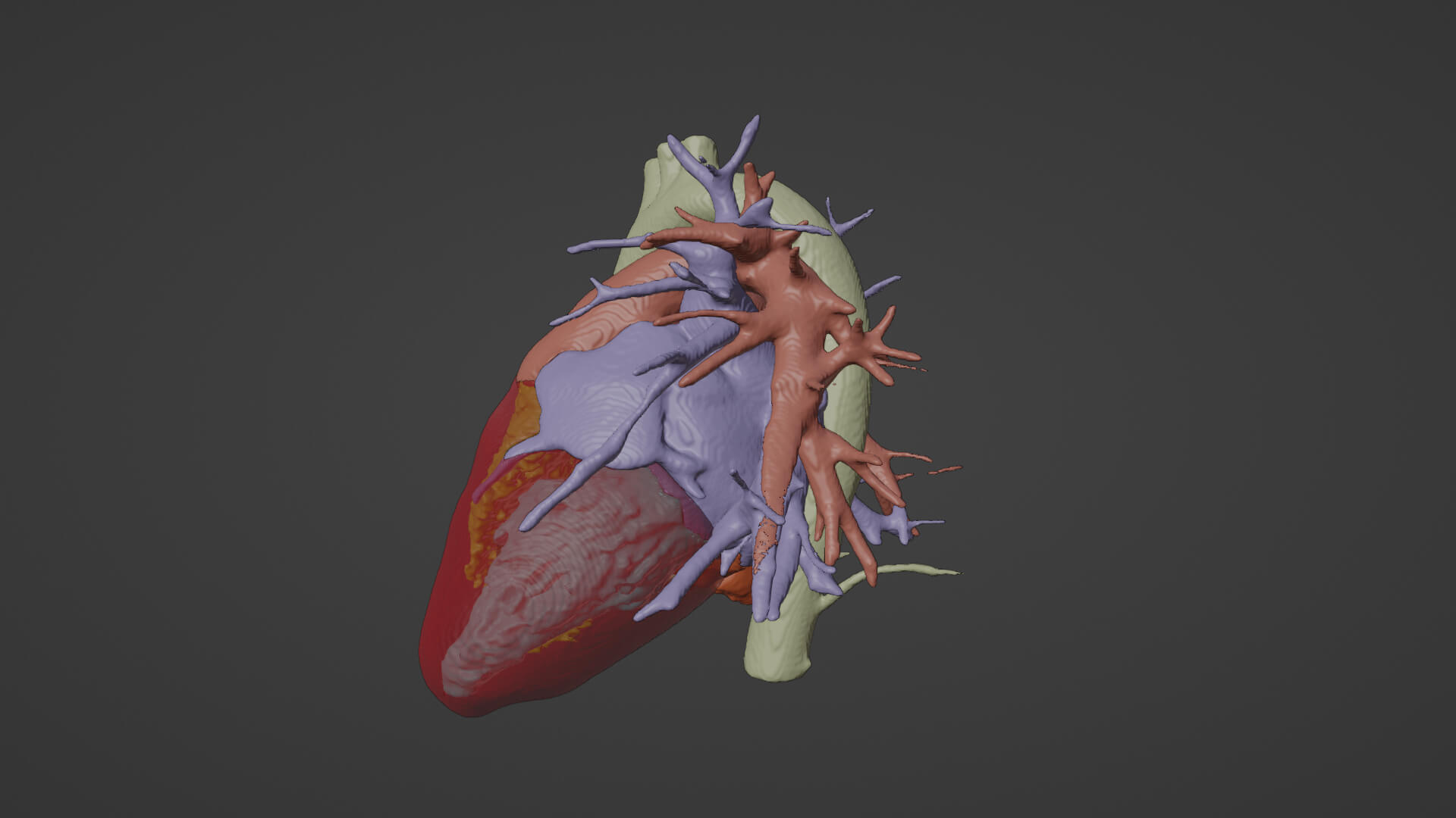 3D Model of Heart From Real Patient by azekapeka