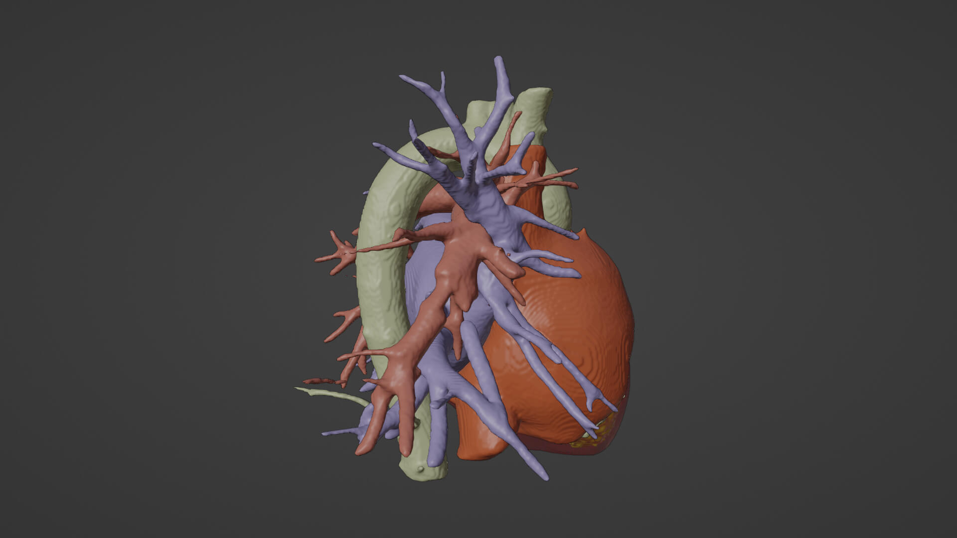 3D Model of Heart From Real Patient by azekapeka