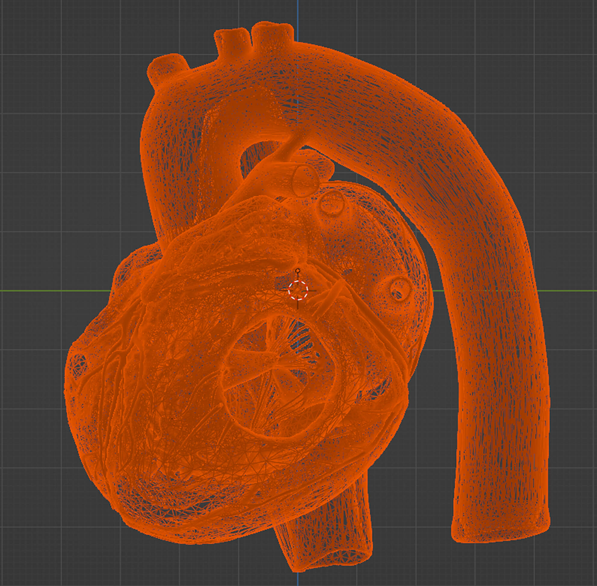 3D Model of Heart With Tetralogy of Fallot (Tof) by azekapeka