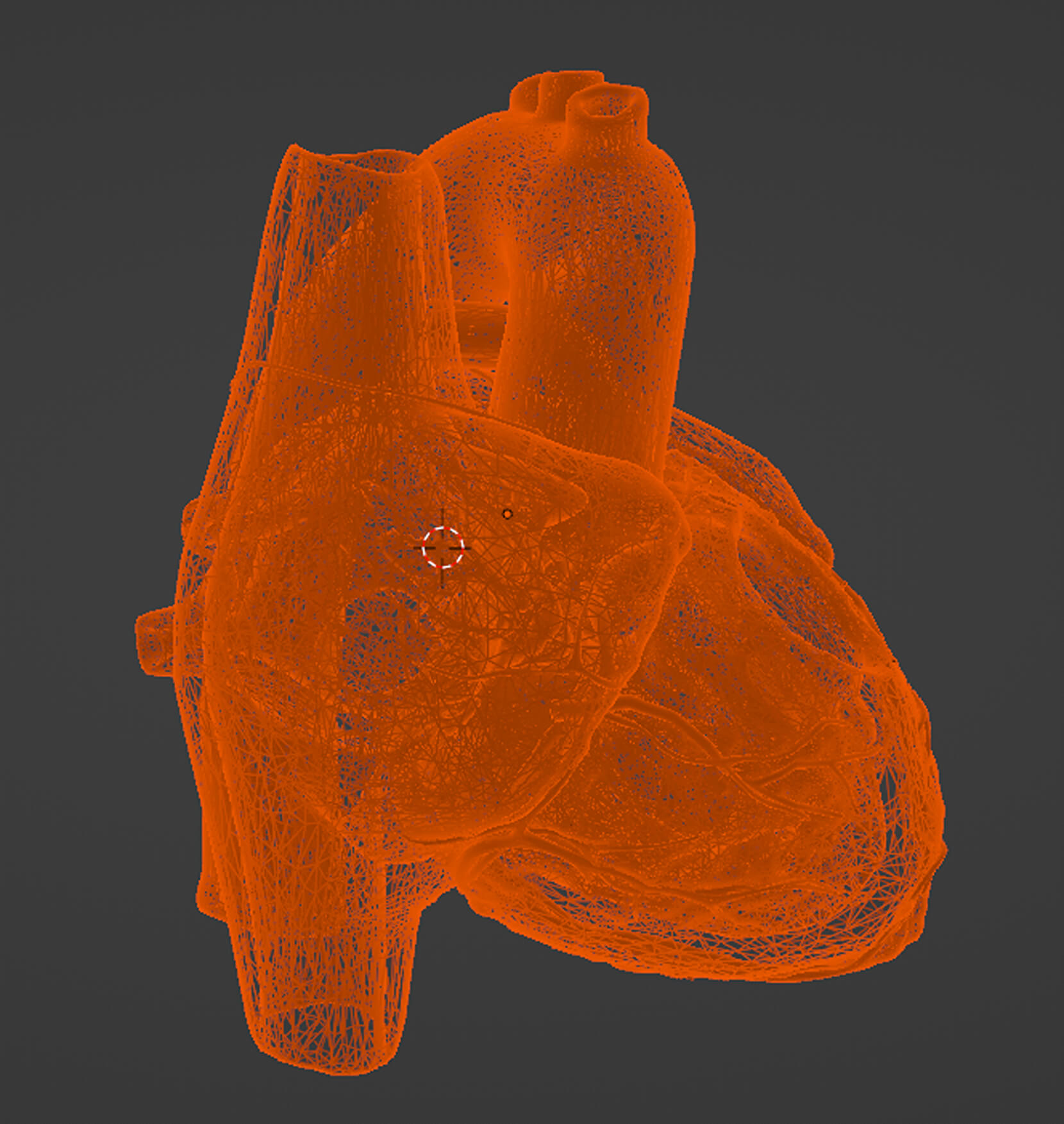 3D Model of Heart With Tetralogy of Fallot (Tof) by azekapeka